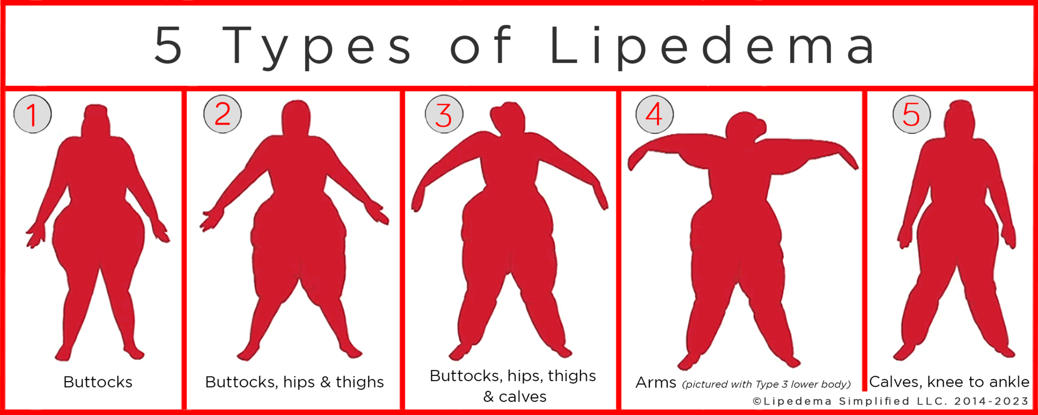 My Lipedema Story – Part 5 – Finding a Diagnosis – The Healing Blossom