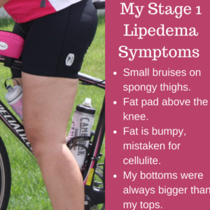 My Lipedema Story – Part 1 – The Weight Won’t Budge – The Healing Blossom