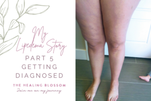 Lipedema – The Healing Blossom